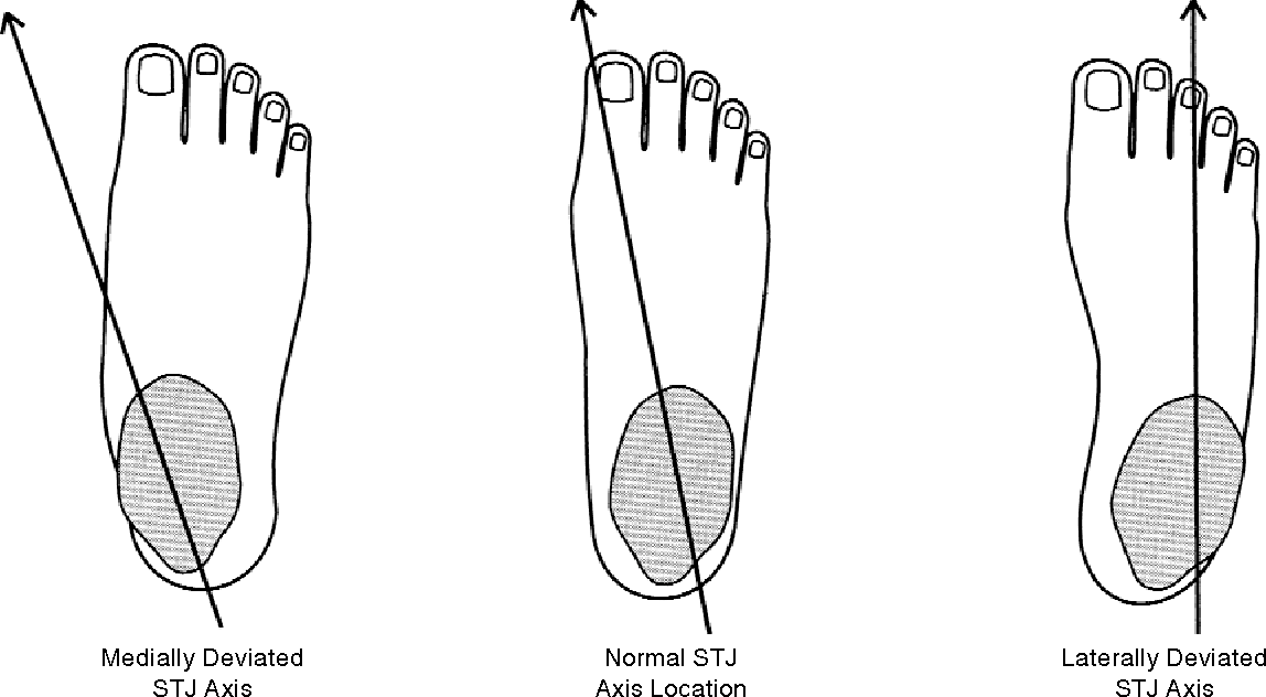 Normal And Abnormal Feet Manufacturers and Supplier In India